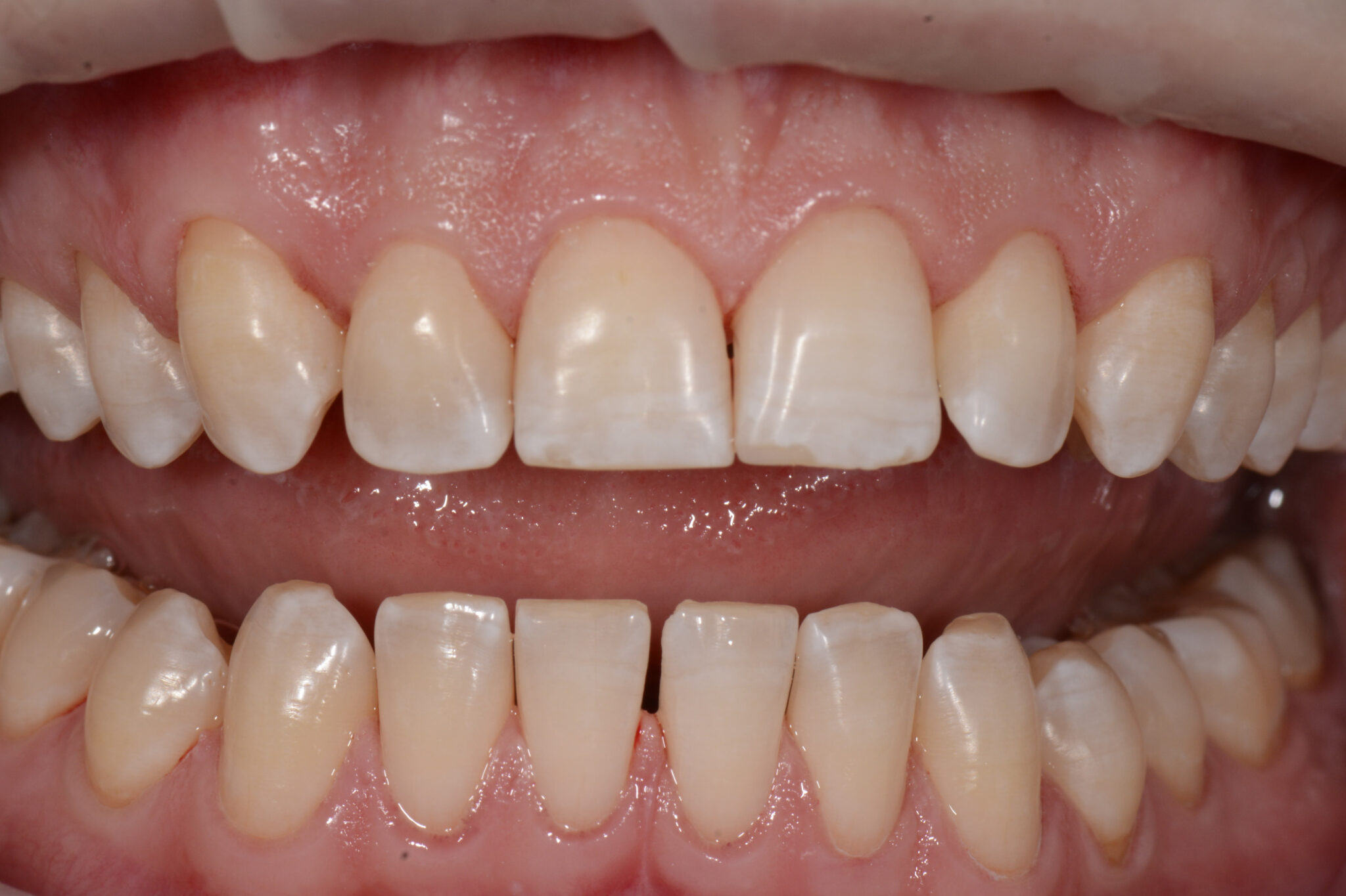 Burnos higiena Kaune kaina | Atsiliepimai ir akcijos | dantuestetika.lt